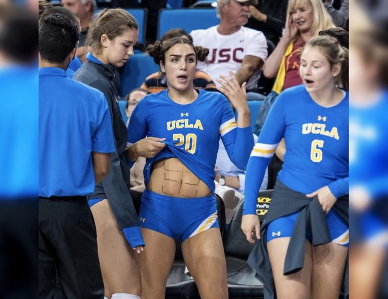 The Funniest Sports Moments, 25 Photos